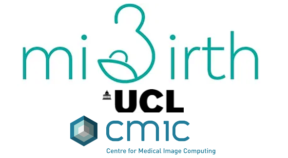 MiBirth: Magnetic Resonance Imaging in late pregnancy | UCL POND Research Group